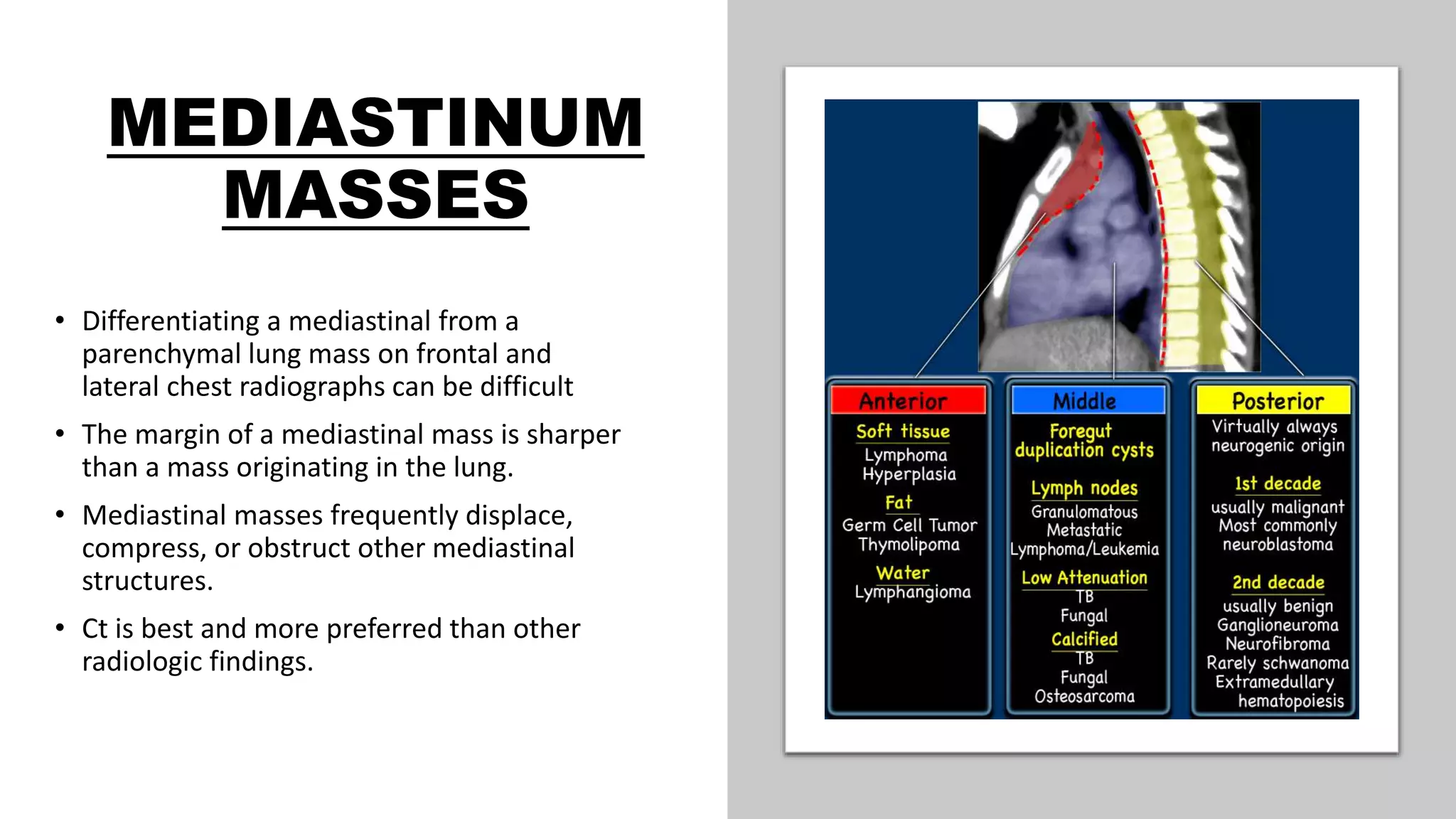 Radiological study on Mediastinal masses | PPTX