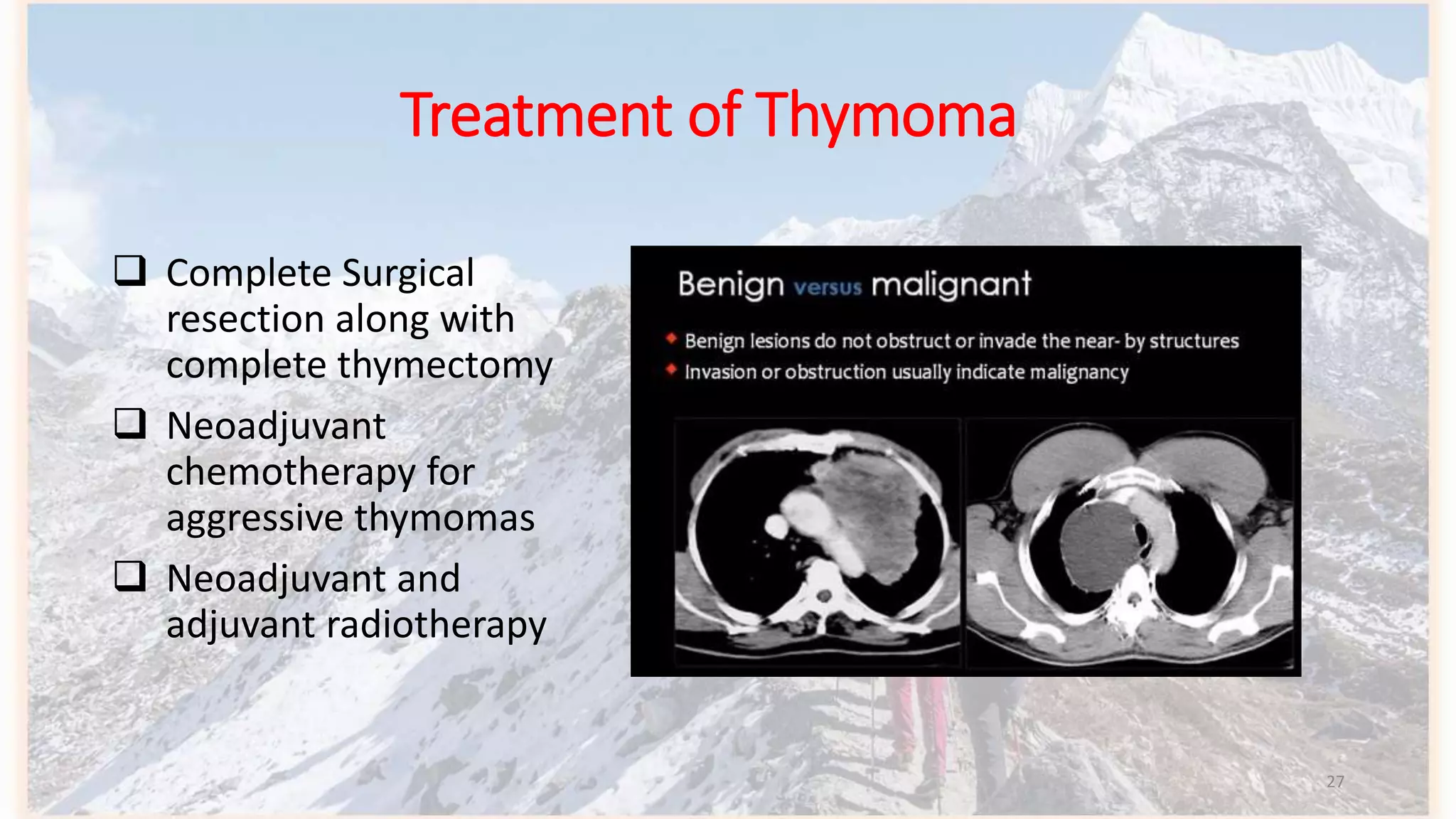 Approach to Mediastinal Mass | PPTX