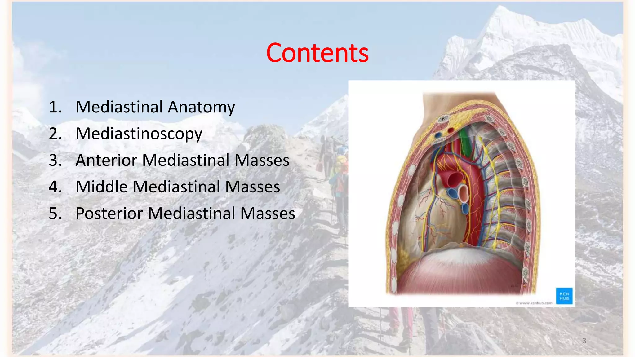 Approach to Mediastinal Mass | PPTX