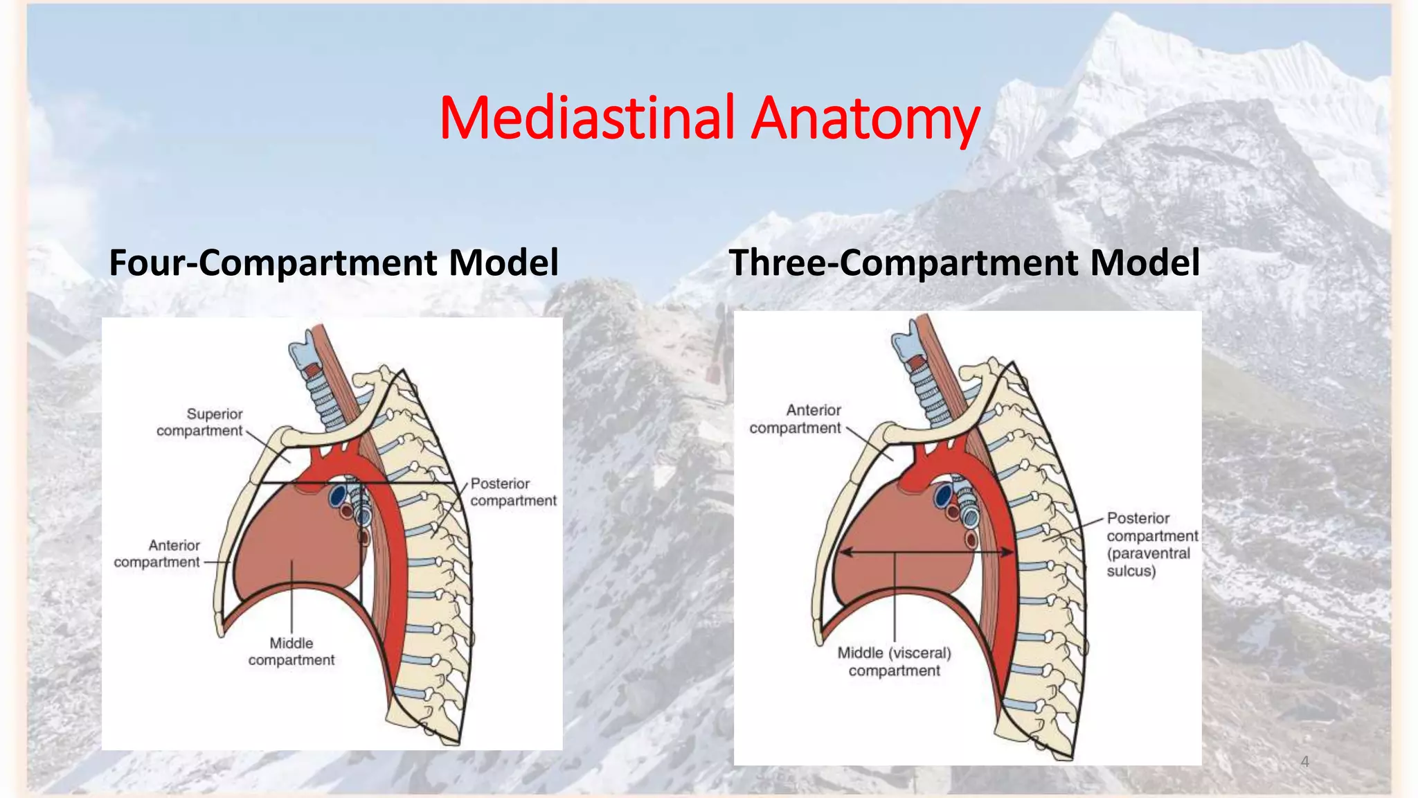 Approach to Mediastinal Mass | PPTX