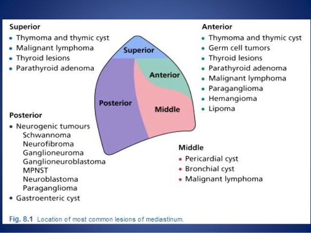 Mediastinal syndrome