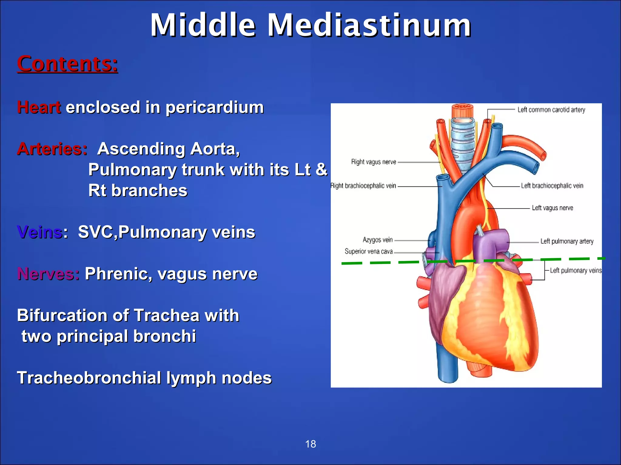 Mediastinal tumors | PPT