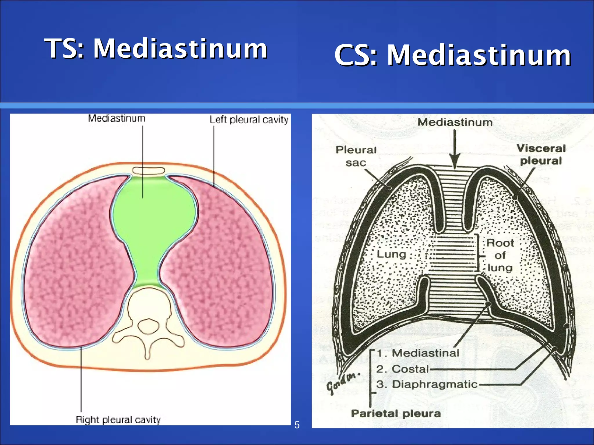 Mediastinal tumors | PPT