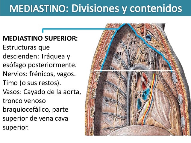 Mediastino