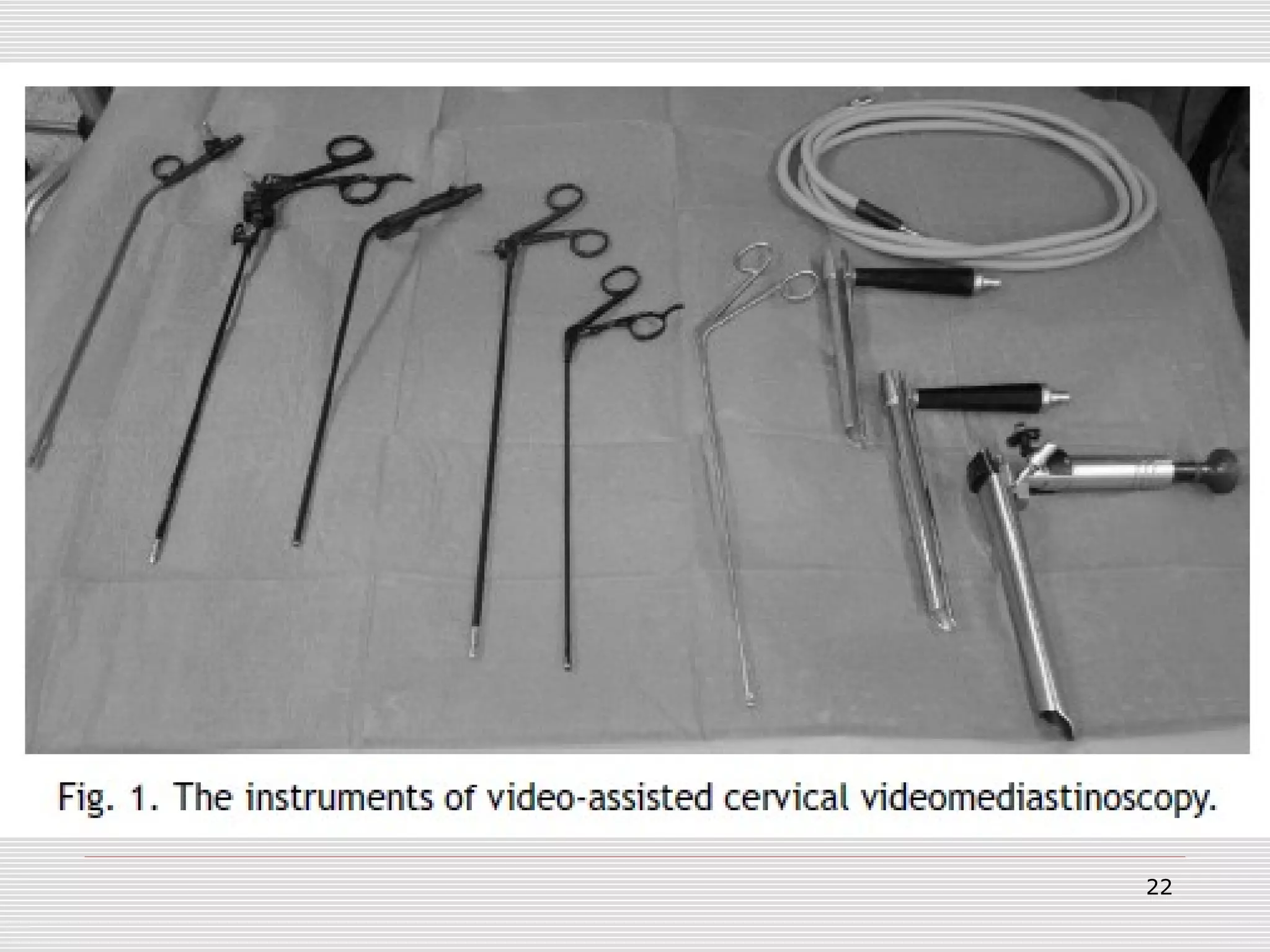 Mediastinoscopy & mediastinotomy indications & techniques | PPT