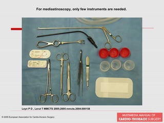 Mediastinoscopy & mediastinotomy indications & techniques | PPT