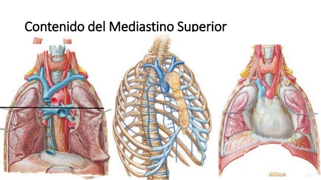 Mediastino superior