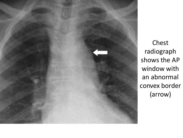 Mediastinum-RADIOLOGY