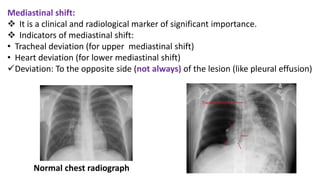 Mediastinum | PDF | Heart and Cardiovascular Diseases | Diseases and ...