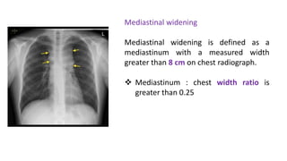 Mediastinum | PDF | Heart and Cardiovascular Diseases | Diseases and ...