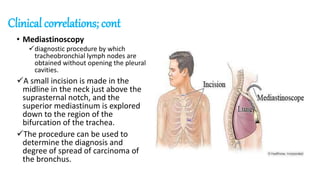 Mediastinum.pptx