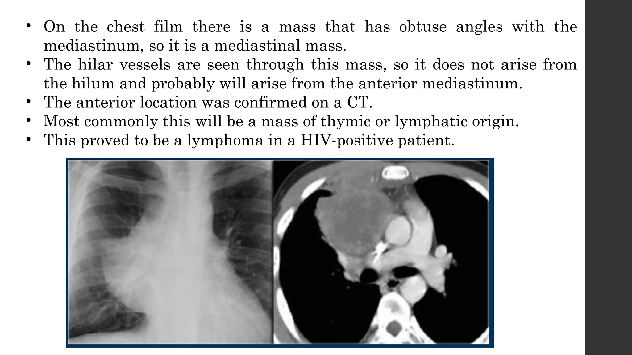 Anatomy & Radiology of the Mediastinum.pptx