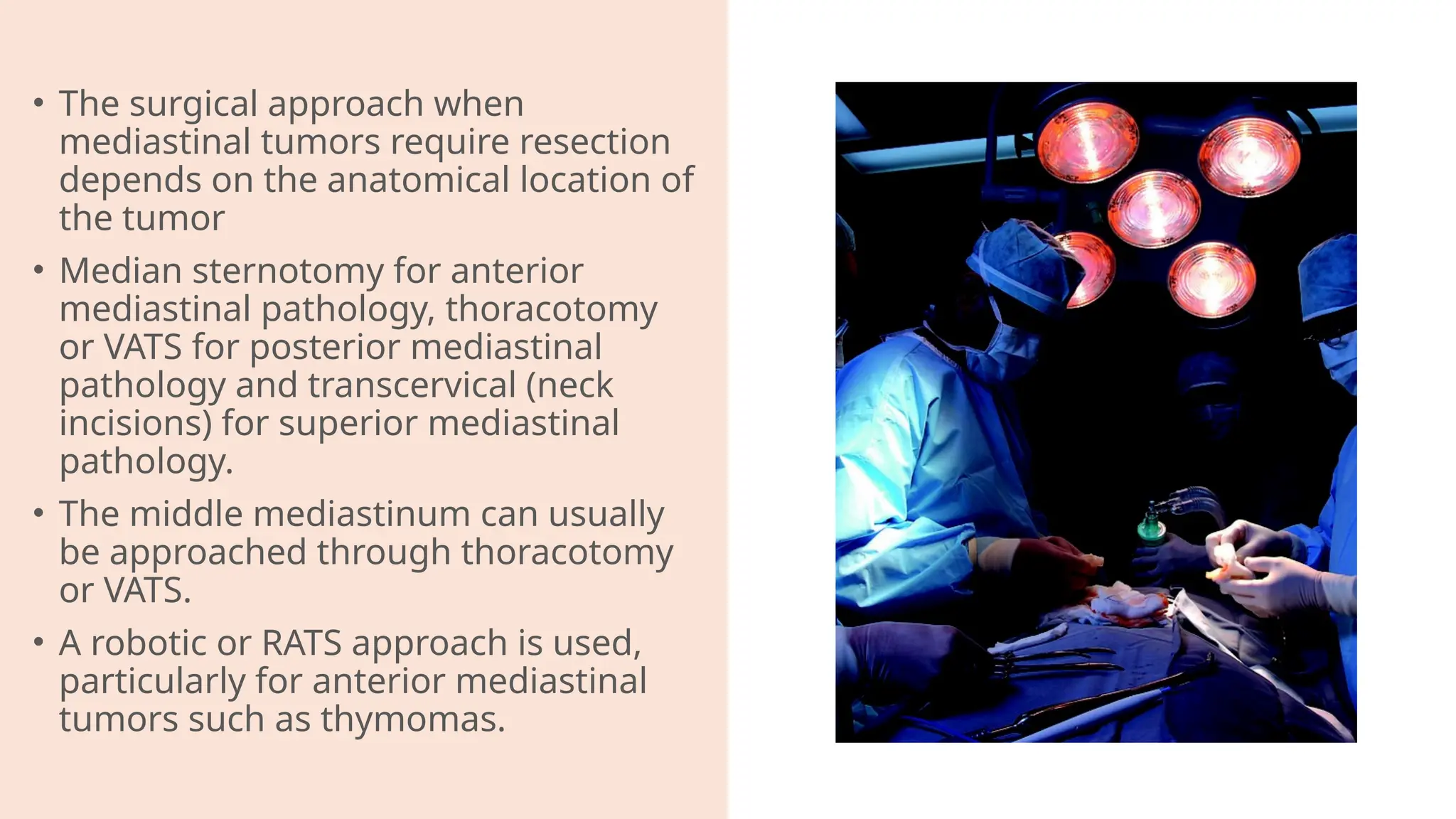mediastinum and primary tumors of mediastinum | PPTX