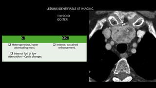 Radiology - Anatomy & Imaging of mediastinal mass | PPTX