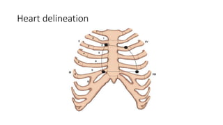 Mediastinum and heart position | PPT