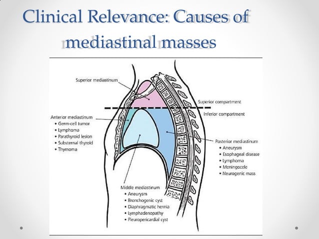 Mediastinum By Dr Rabia Inam Gandapore.pptx | Lung and Respiratory ...