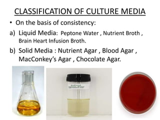 MEDIA USED IN MICROBIOLOGY.pptx
