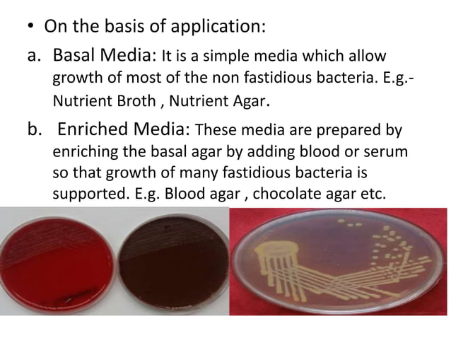 MEDIA USED IN MICROBIOLOGY.pptx