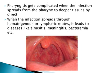Streptococcus pyogenes | PPTX