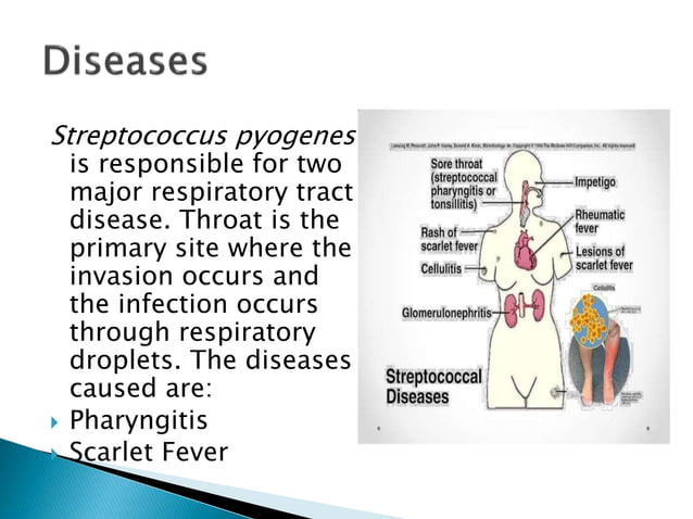 Streptococcus pyogenes | PPTX