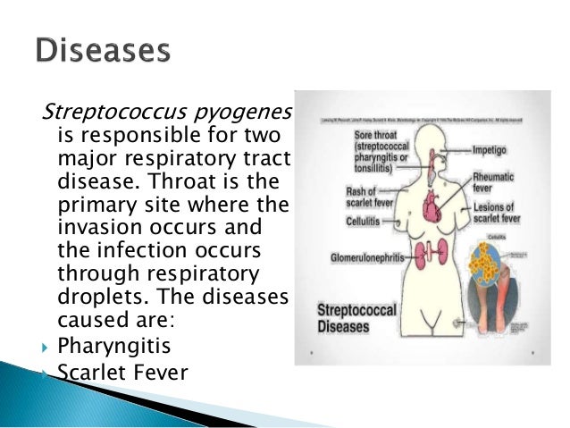 Streptococcus pyogenes