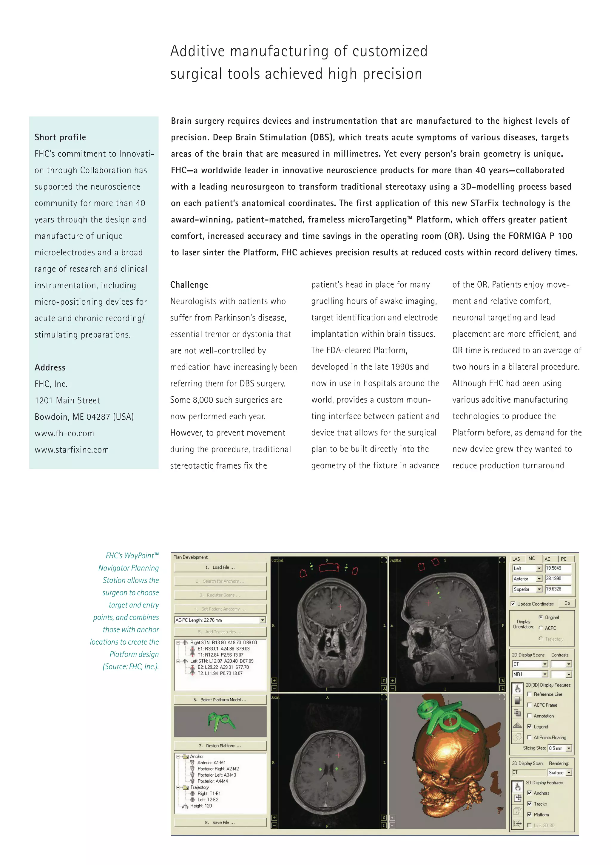 FHC switches to EOS technology for manufacturing of stereotactic ...
