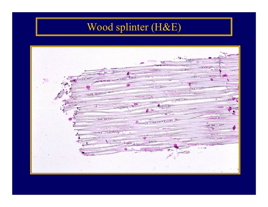 Medical Foreign Bodies
