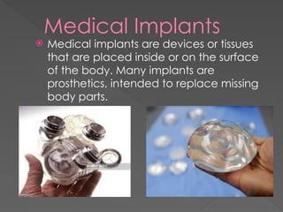 Medical-Implants-and-Prosthetics.......... | PPTX