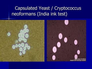 Introduction to Medical mycology | PPTX