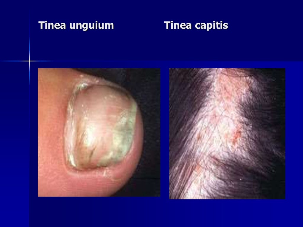 Introduction to Medical mycology