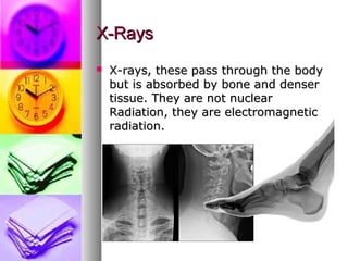 Medical Uses of Radiation.ppt