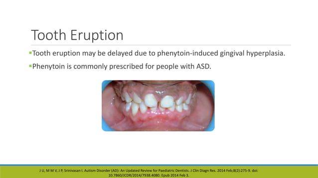 Medical ,dental manifestations and management of autism spectrum ...