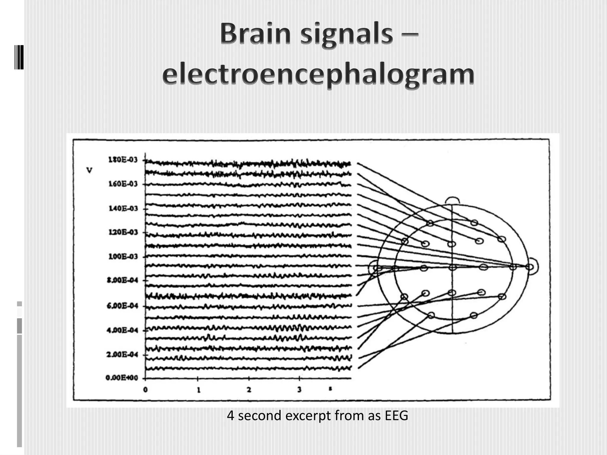 Medical applications of dsp | PPTX | Digital Audio | Computer Software and Applications