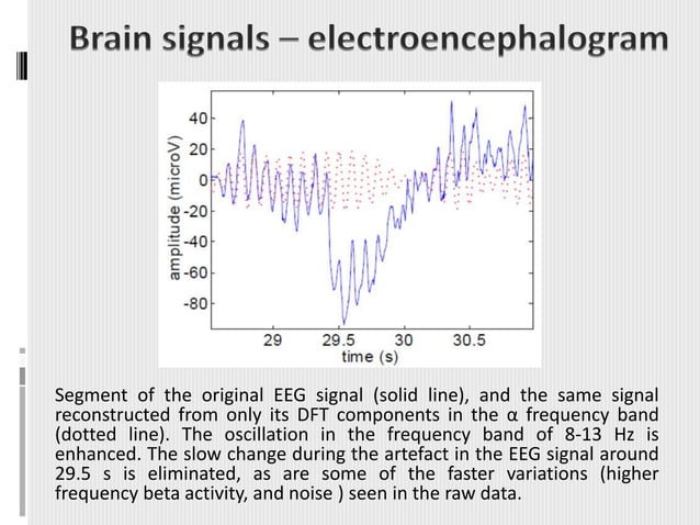 Medical applications of dsp | PPTX | Digital Audio | Computer Software and Applications