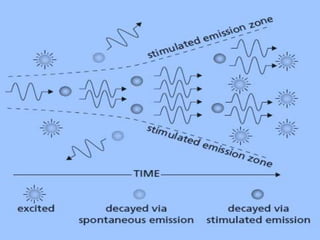 Medical applications of laser | PPSX | Eye and Vision Conditions ...