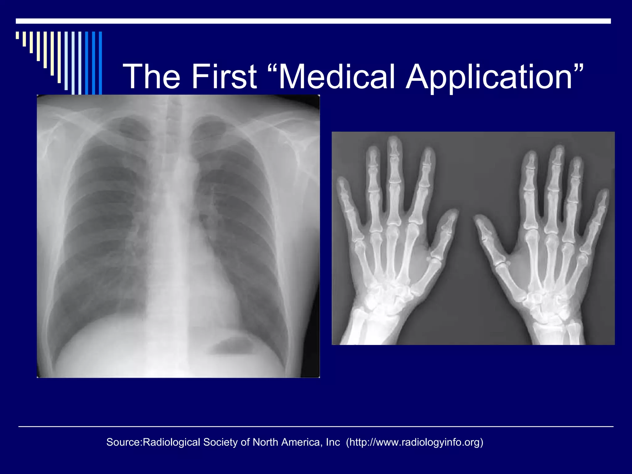 Medical applications of nuclear physics | PPT
