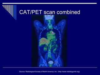 Medical applications of nuclear physics | PPT