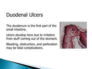 Medical aspects of addiction and co occurring disorders | PPTX