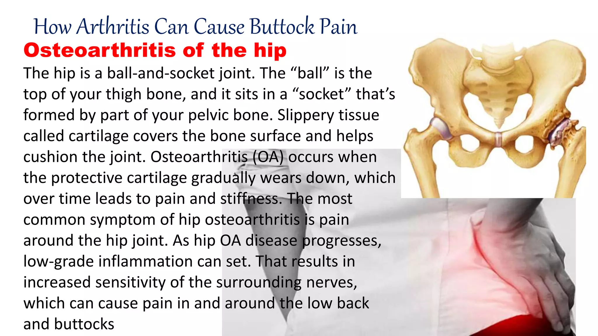 Medical aspects of buttocks (gluteus maximus,gluteus medium,gluteus ...
