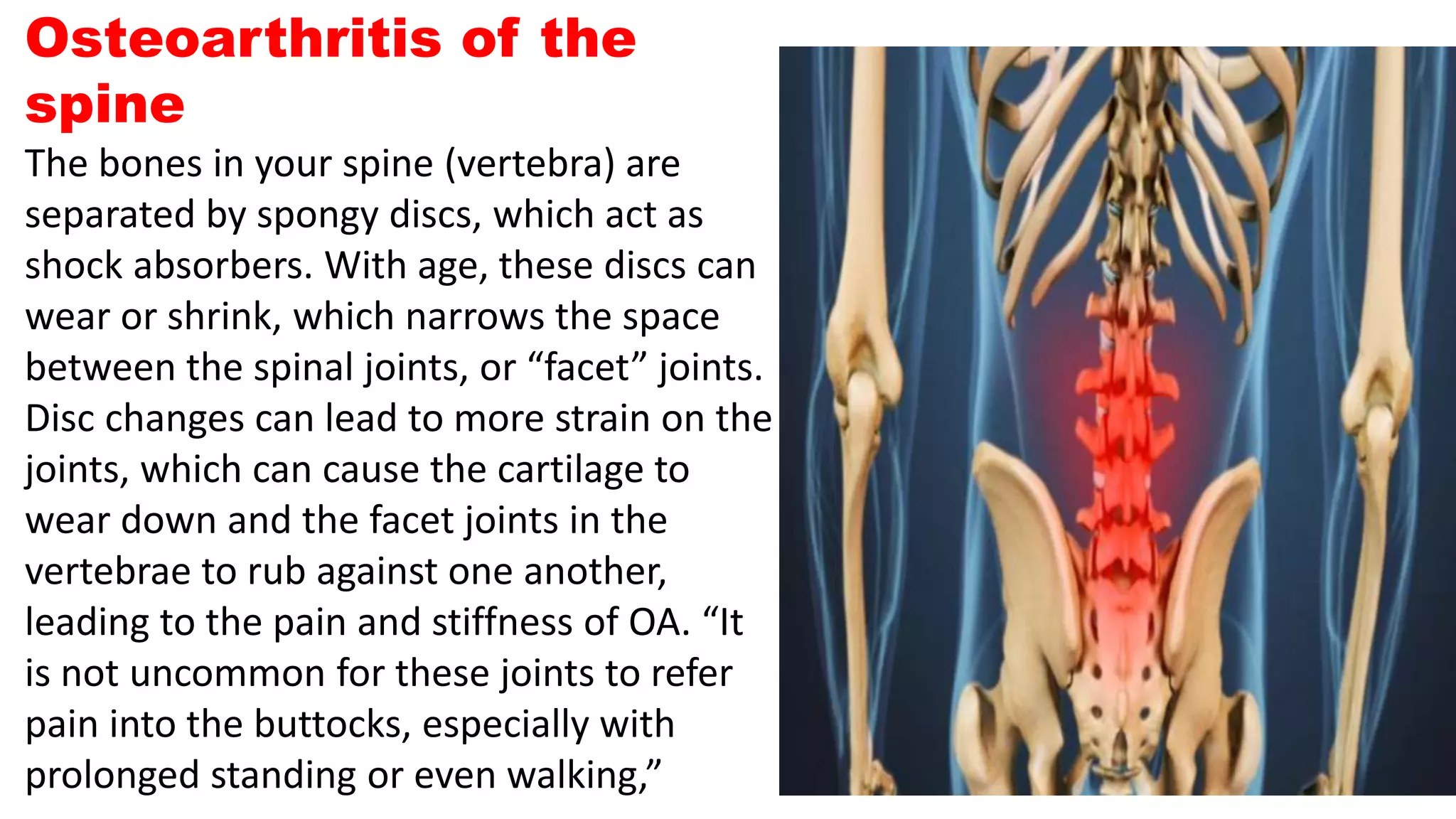 Medical aspects of buttocks (gluteus maximus,gluteus medium,gluteus ...