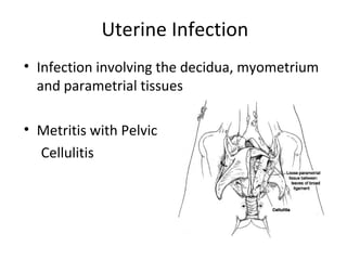 Medical Complications in Pregnancy | PPT