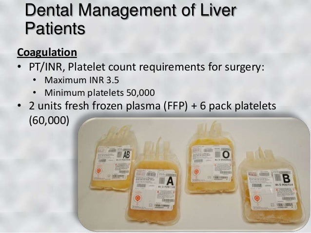Dental Patients with Liver Disease