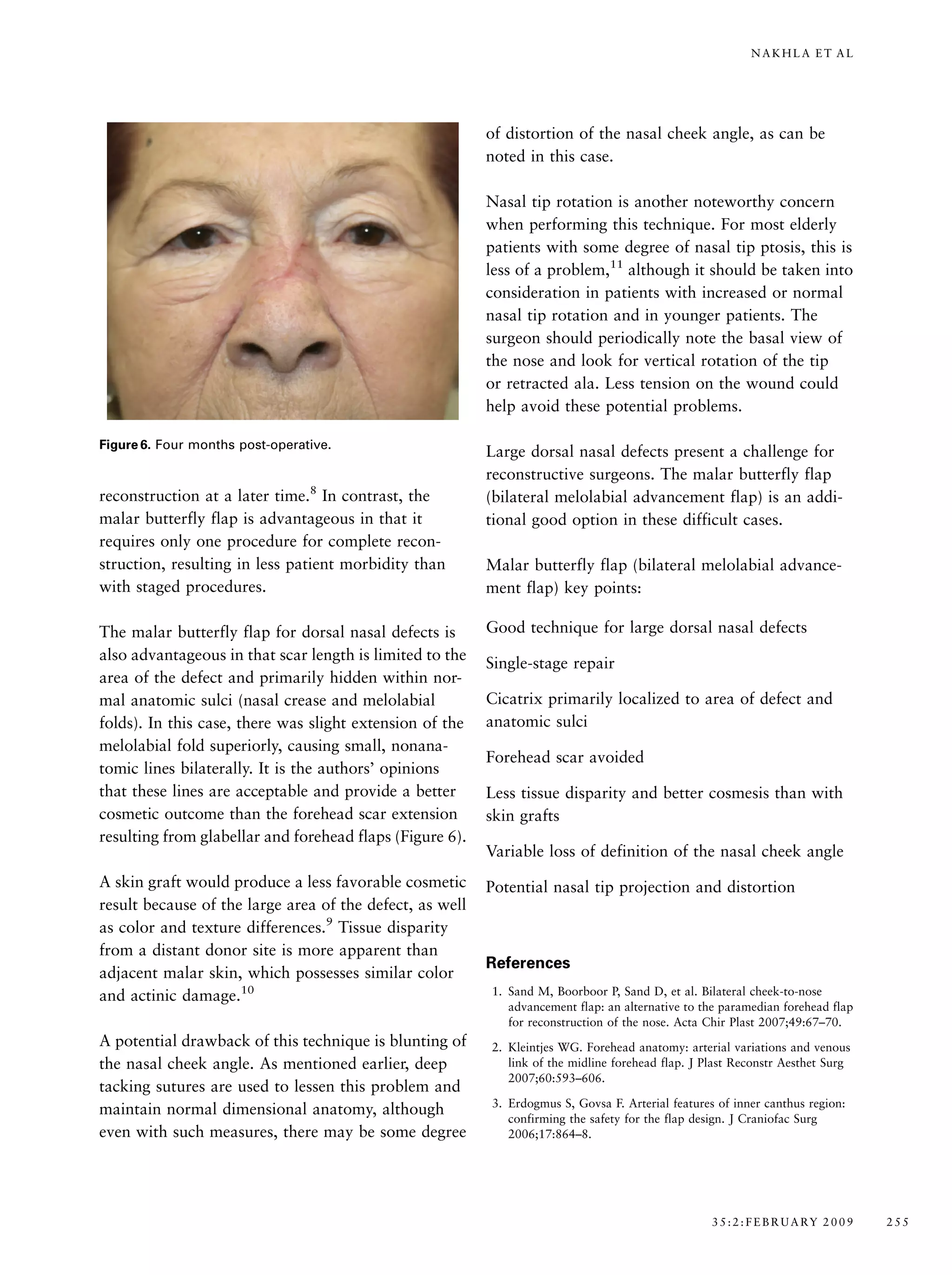 Medical dermatology studies malar butterfly flap | PDF