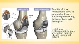 Medical device knee implant | PPT