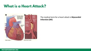 Medical emergencies - Heart Attack | PPTX