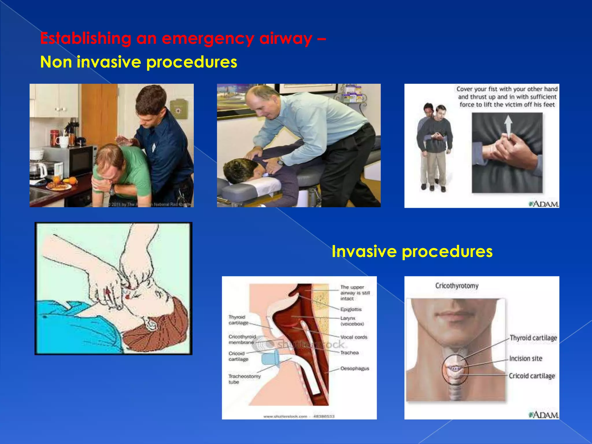 Medical emergencies dental office | PPTX
