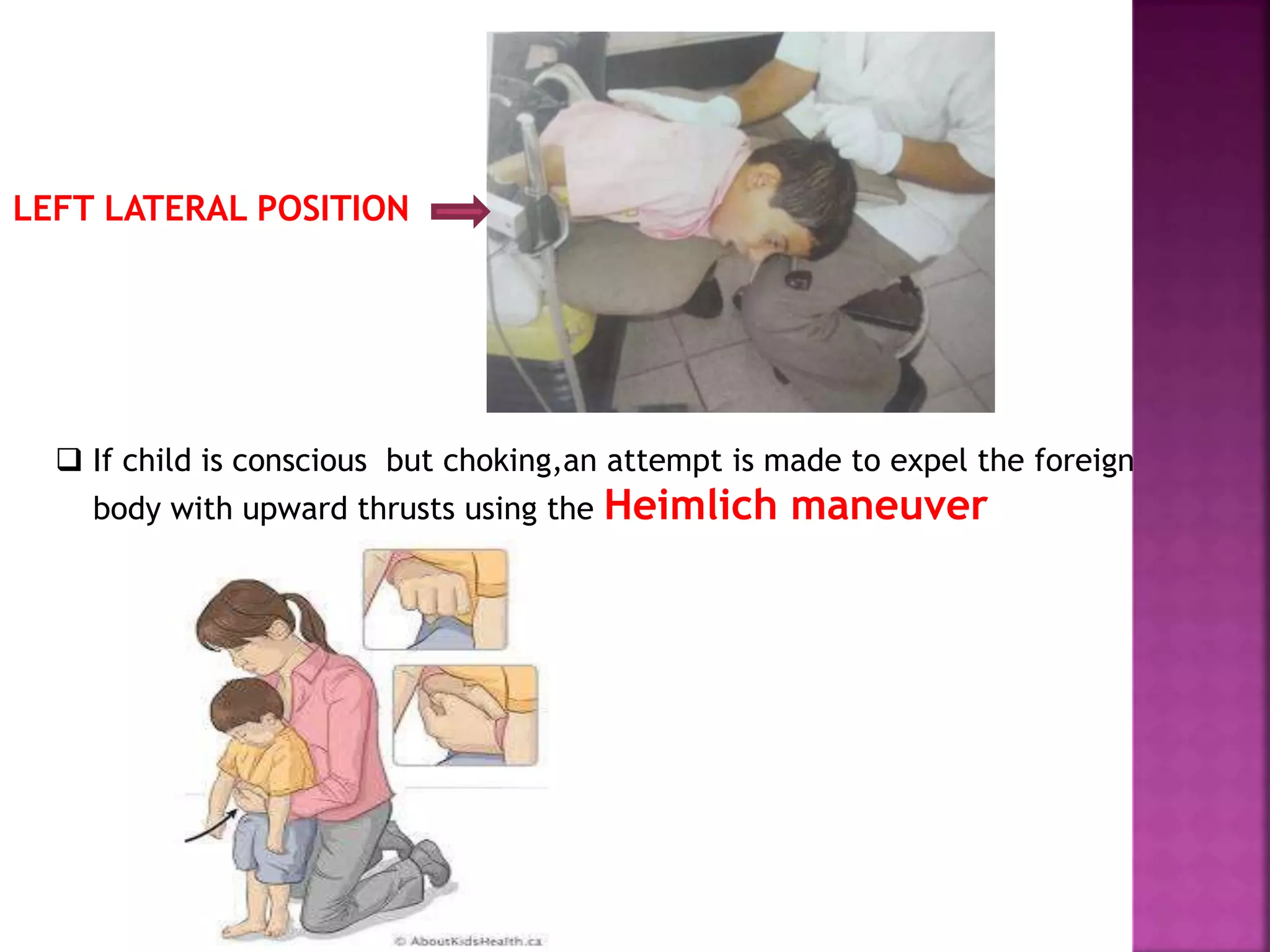 Medical emergencies in pediatric dental practice | PPTX