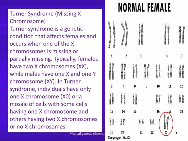 medical genetics chromosomal disorders.pdf