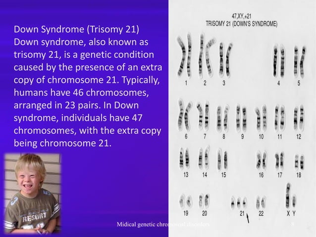 medical genetics chromosomal disorders.pdf