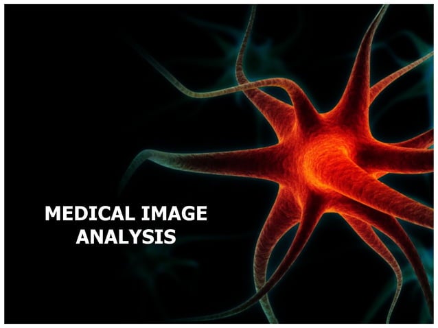Medical image analysis | PPT